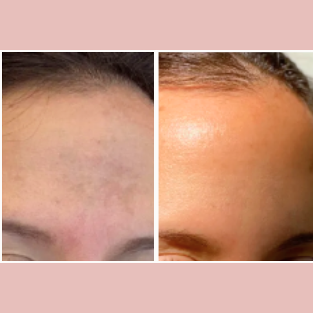 Brightening Skincare | Target Hyperpigmentation & Uneven Skin Tone ...